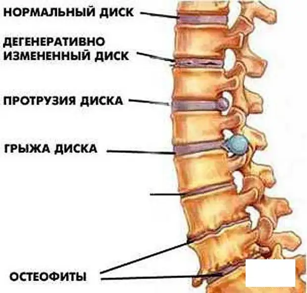 Агар пушти пои шумо дард кунад