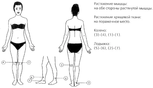 истегнување на мускулите, истегнување на 'рскавицата, коленото, глуждот.