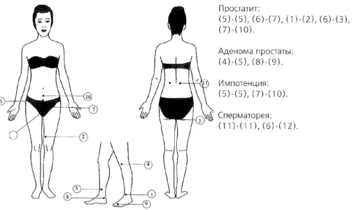 prostatitis, adenoma'r prostad, analluedd, sbermatorrhea.