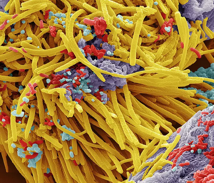 Fotografie č. 5 - Manažerská společnost: jak bakterie ovládají lidi