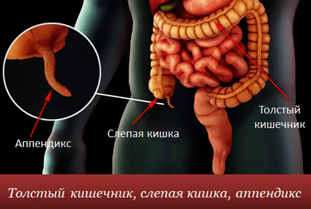 Appendicitis. Matšoao ho batho ba baholo