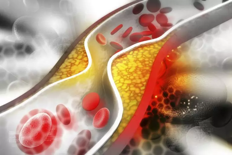 Otu esi eweda ọkwa cholesterol 