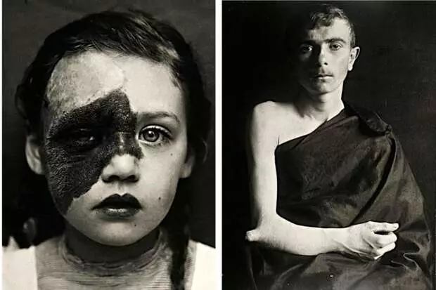 Retratos del dolor: imágenes impactantes de pacientes del siglo XIX que padecen enfermedades graves
