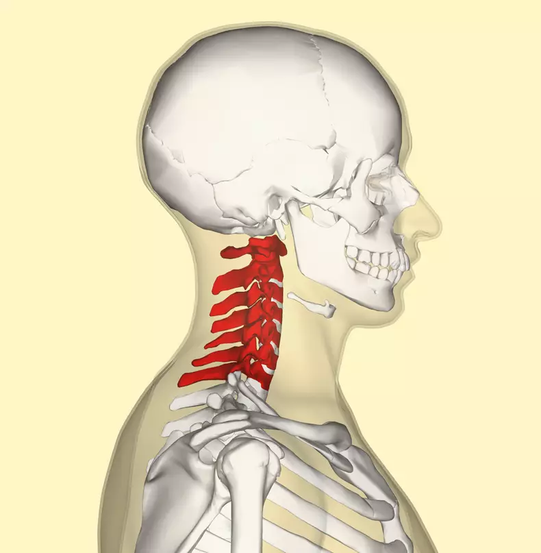 Kako se znebiti glavobola: Osteopatova tehnika