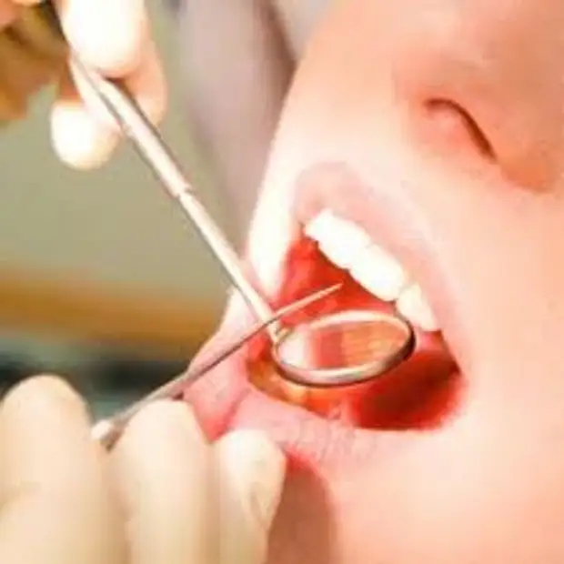 Dental treatment under hypnosis