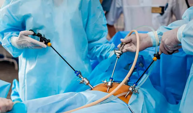 Laparoskopie: Sleutelgatchirurgie