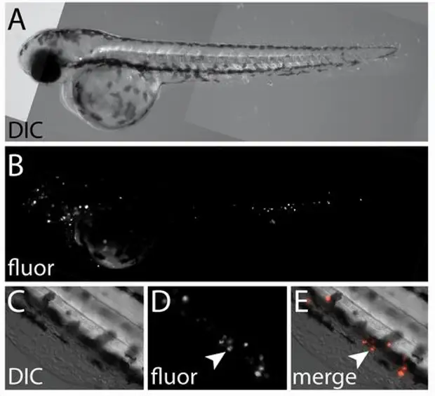 Kub nanoparticles yeej mob qog noj ntshav thiab atherosclerosis