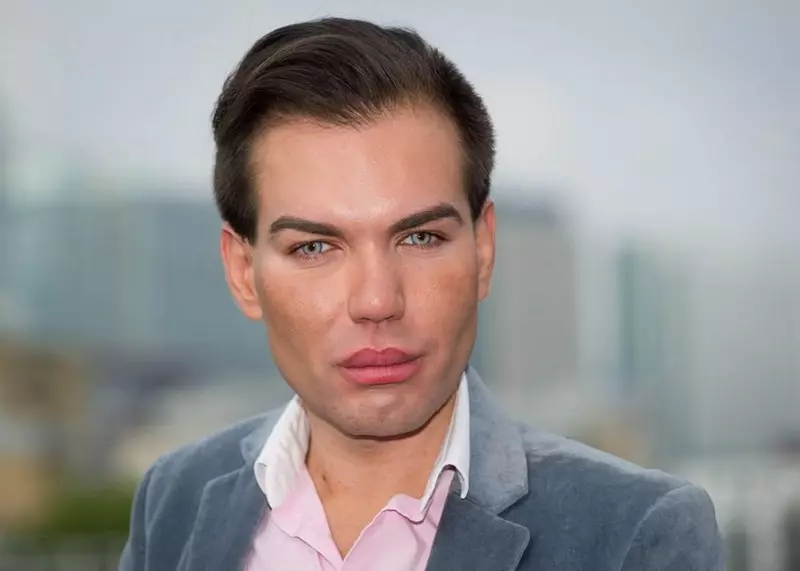 Rodrigo Alves: žijúca ken krása, úpravy, operácie, plastická chirurgia, plastická chirurgia, premeny, fotky, čudáci