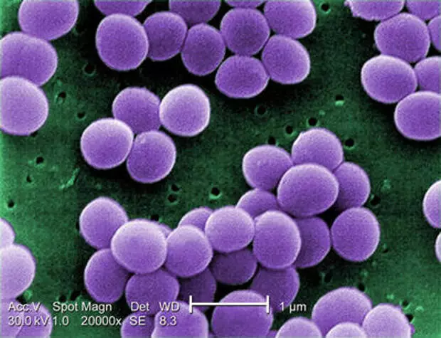 staphylococci د مایکروسکوپ لاندې د انګورو یوې ډلې ته ورته دی